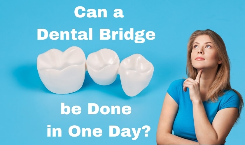 One-Day Dental Bridge: Speedy Smile Restoration