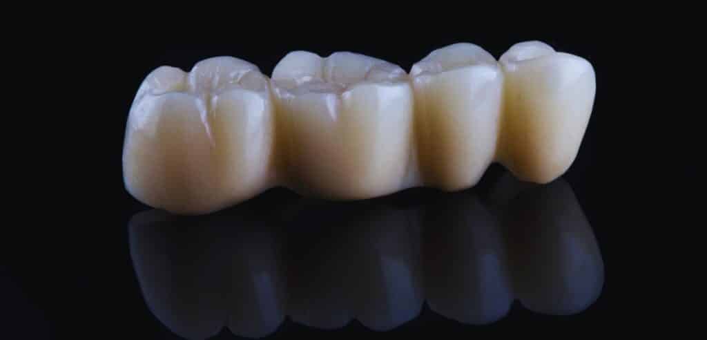 Smile Brighter: An Overview of Dental Crowns for Stronger Teeth